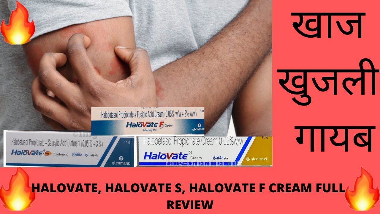 HALOVATE, HALOVATE F, HALOVATE S FULL REVIEW CREAM, क्या यह है खुजली का ...