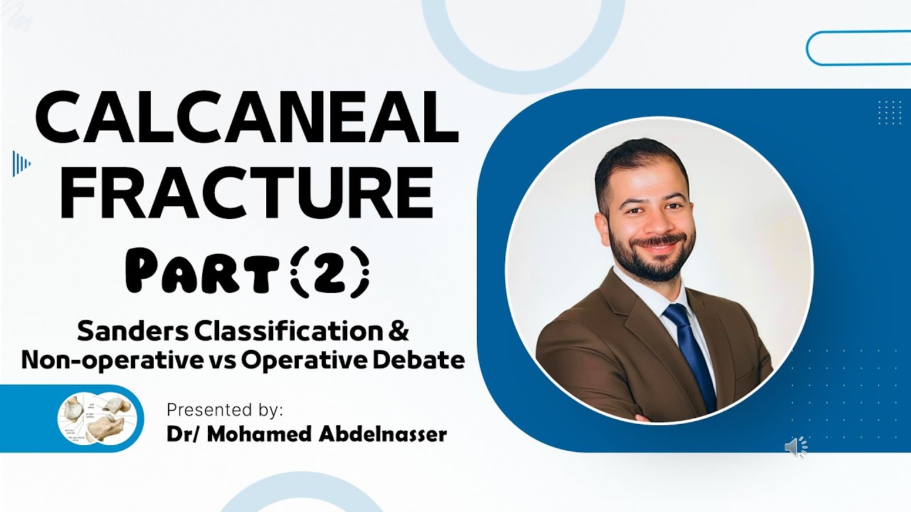 CALCANEAL FRACTURE | Part (2) | Sanders Classification & Non-operative ...
