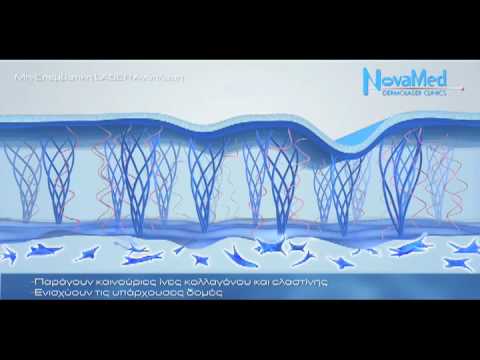 Medical Animation - Cosmetic Surgery - YouTube