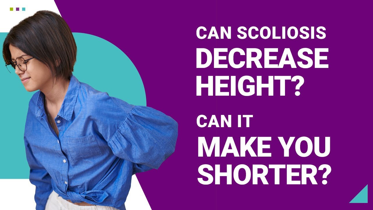 Can Scoliosis Decrease Height? Can it Make You Shorter? - YouTube
