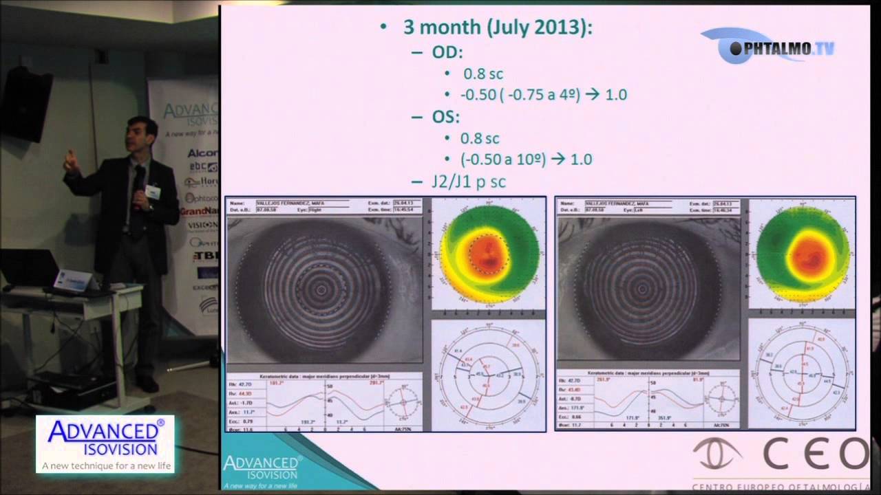 Dr Claudio ASSADI : Présentation de cas normalement Inopérable, opérés ...