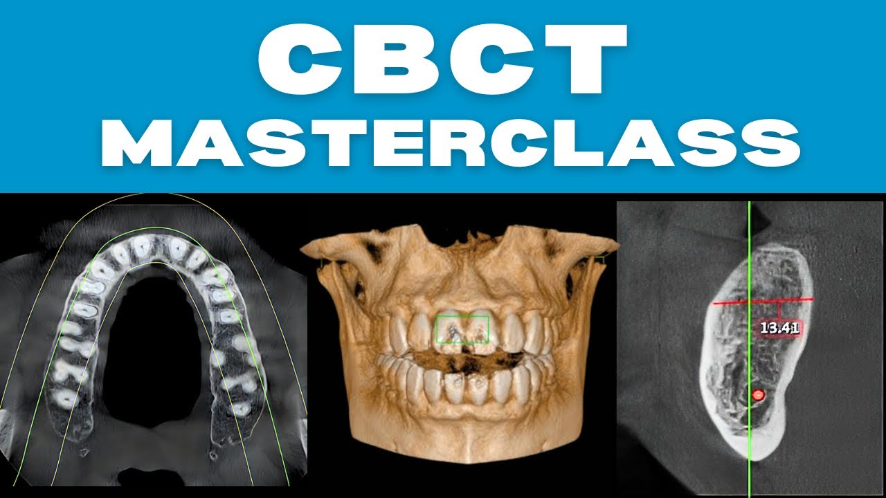 CBCT Masterclass (With Real Case Discussions) - YouTube