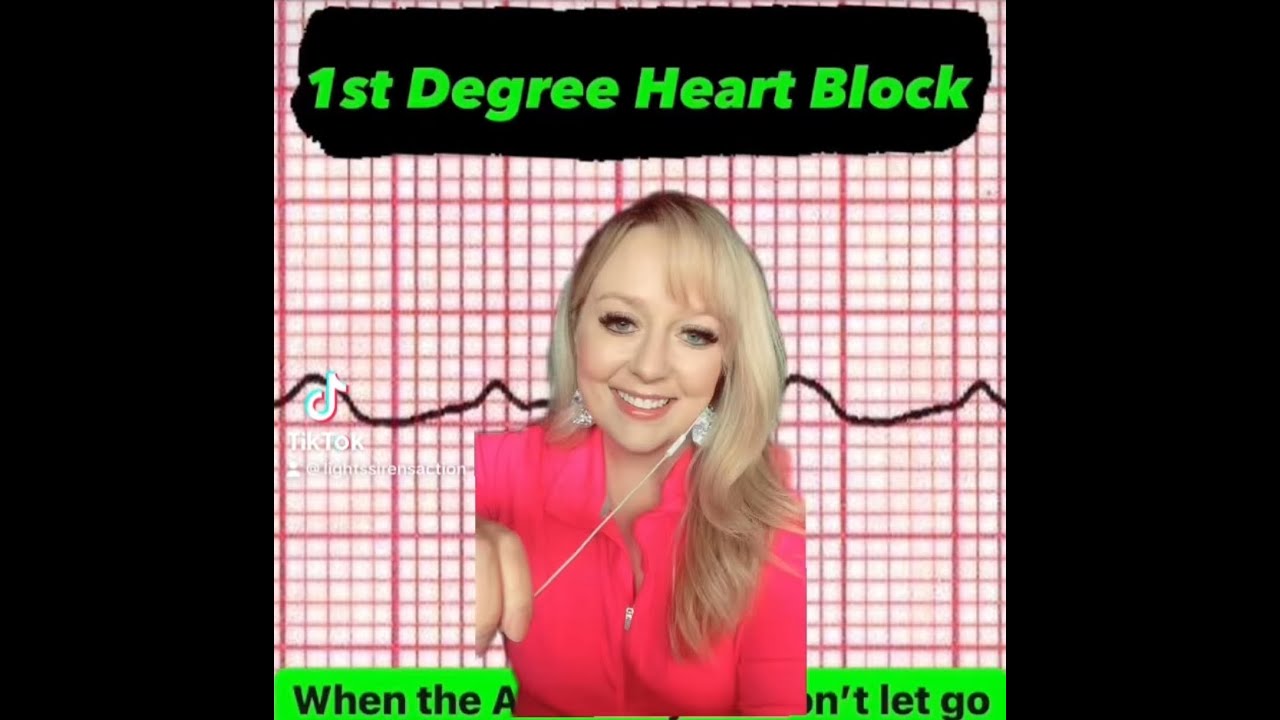 1st Degree Heart Blocks in EMS || EMS Cardiology - YouTube