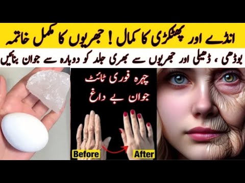 Alum ( Fitkari) For Skin Tightening |Phitkari Benefits and How To Use ...