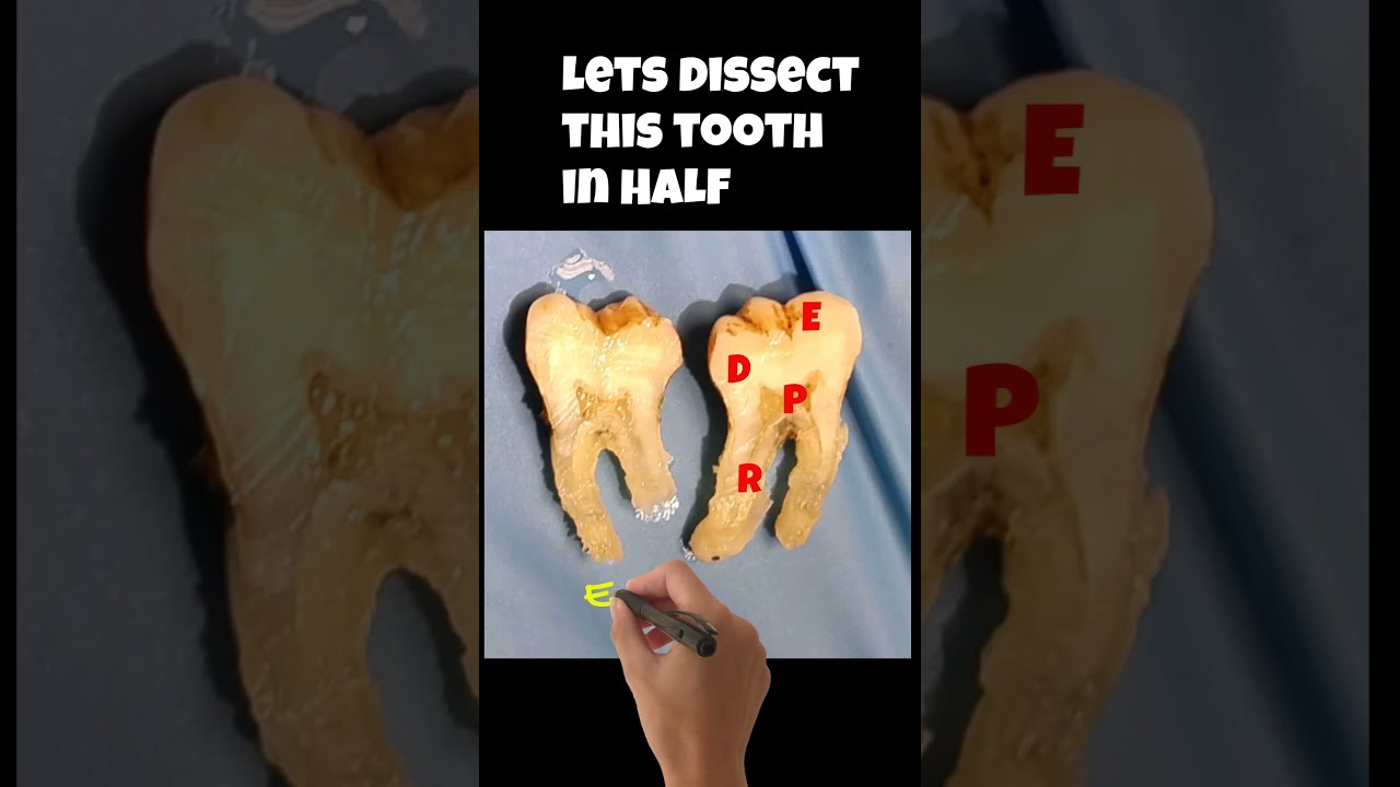 The inside of a tooth anatomy - Dissected in half - YouTube