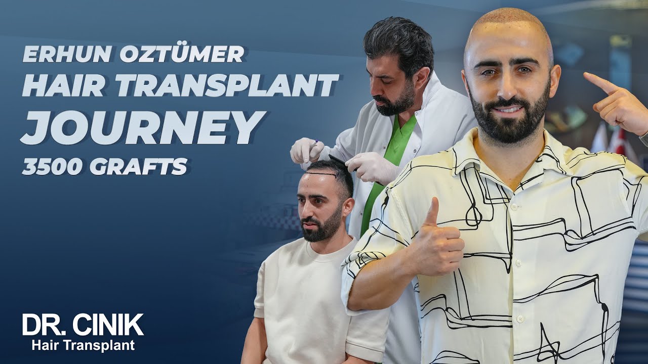 Erhun Öztümer Hair Transplant Journey | Cinik Hair Hospital - YouTube