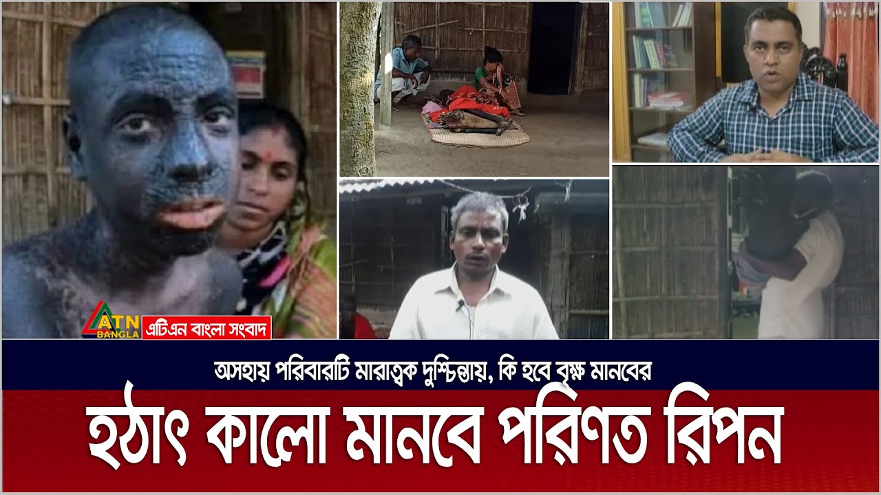 বৃক্ষ মানব থেকে হঠাৎ কালো মানবে পরিণত ঠাকুরগাঁওয়রে রিপন দাস | Brikkho ...