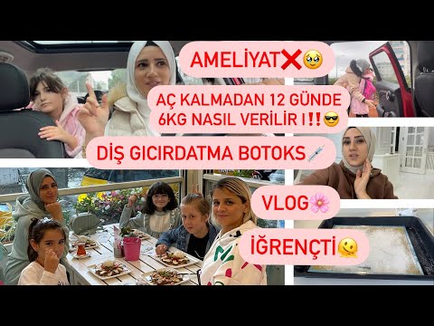 AMELİYATA GİRDİ🥹ÇOK KÖTÜ‼️12GÜNDE 6KG NASIL VERİLİR😎HEDİYETİ HAKETTİ🎁DİŞ GICIRDATMA BOTOKS💉VLOG