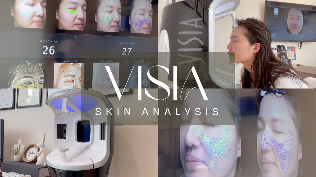 我去做VISIA皮肤测试啦！教你解读VISIA报告，一起看看我的皮肤状态吧！| 美国医美分享 - YouTube
