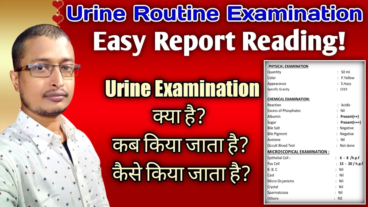 urine-test-report-kaise-dekhe-urine-test-kab-karna-chahiye-urine