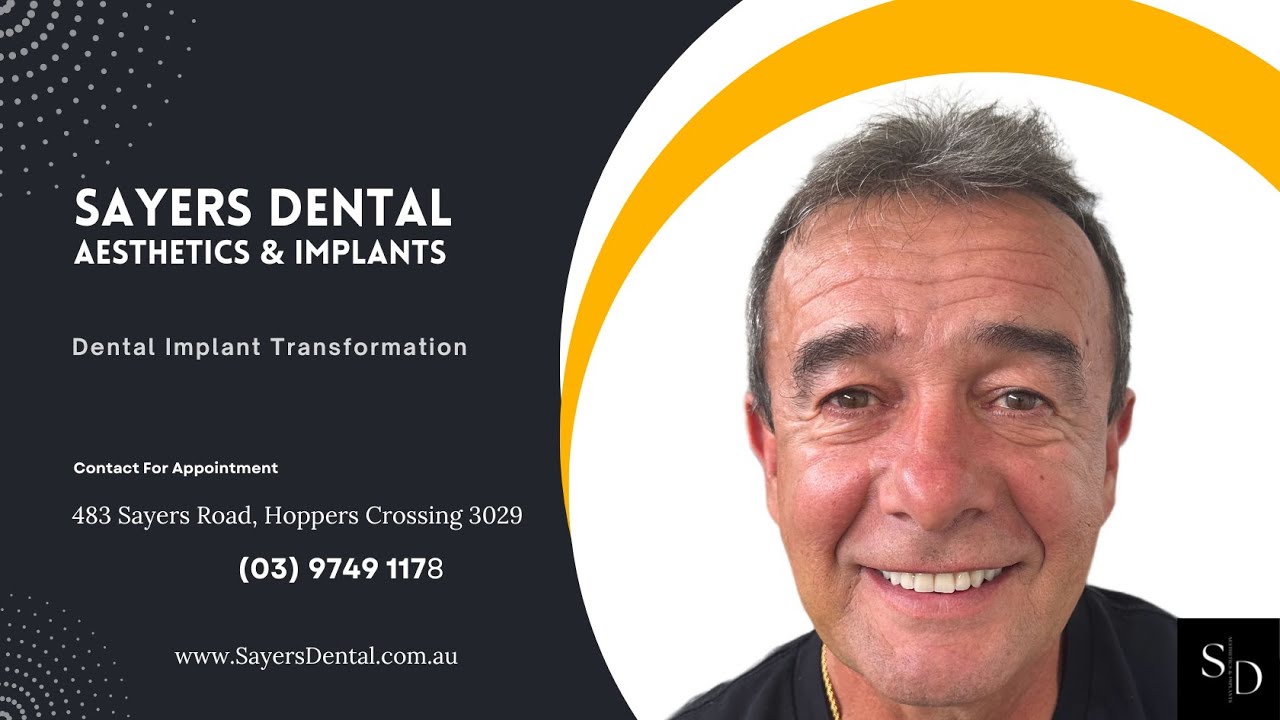 Sayers Dental Aesthetics & Implants - YouTube