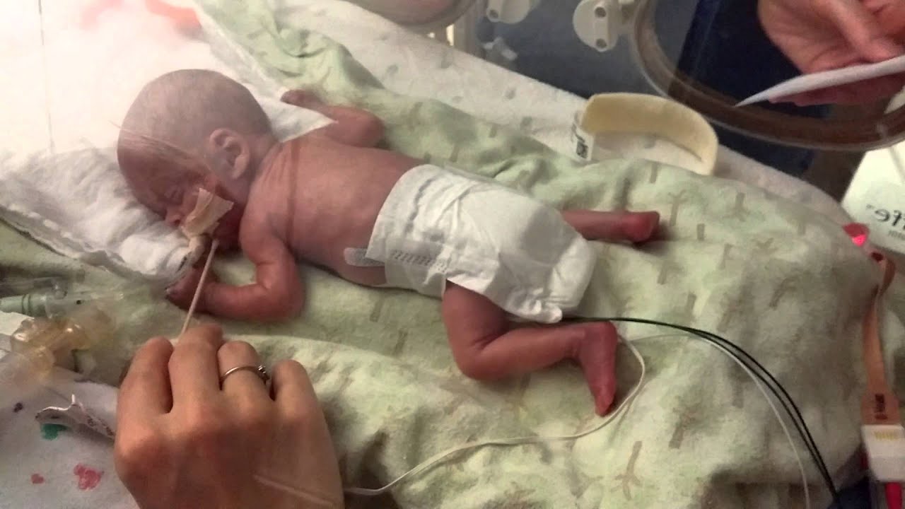 Micro Preemie Footprints - YouTube