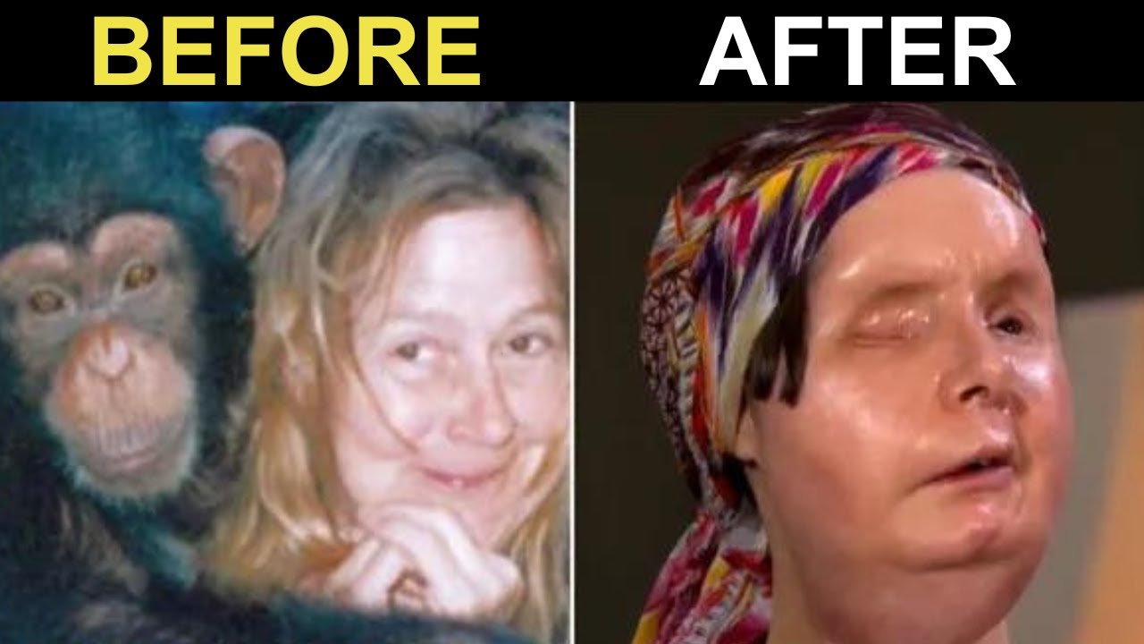 Travis the Chimp Attack in Connecticut: Charla Nash´s Life Turned ...