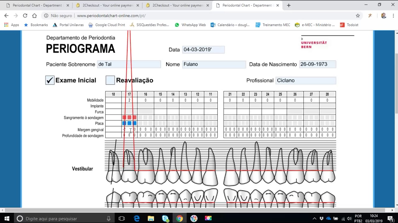 Como usar o Perio Tools - YouTube