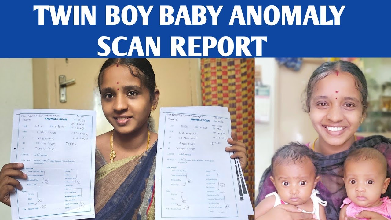 TWIN BOY ANOMALY SCAN REPORT... - YouTube