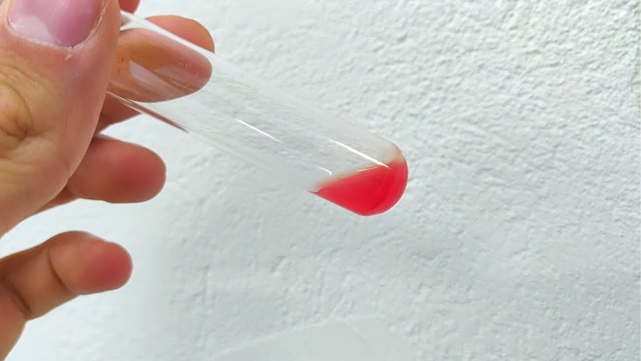 Why Is This Rabbit Blood Clotting Up | Affinity Chromatography and ...