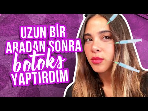 Uzun Bir Aradan Sonra Botoks Yaptırdım! | BELİZ ŞEN VLOG