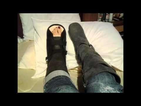 Girls in leg casts - YouTube