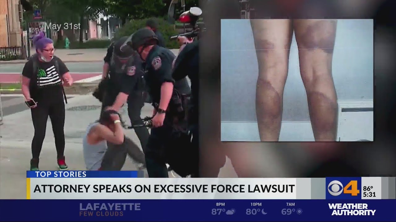 Attorney speaks on excessive force lawsuit - YouTube