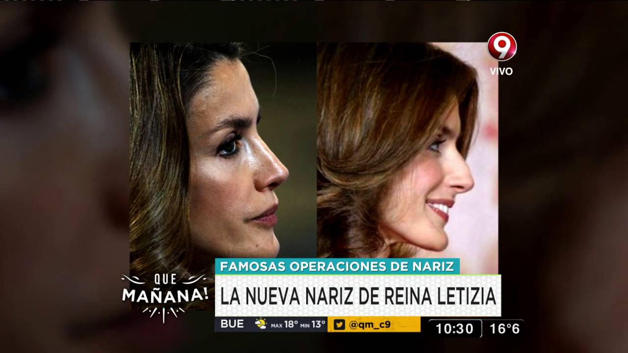 Buenas Operaciones De Nariz De Famosos