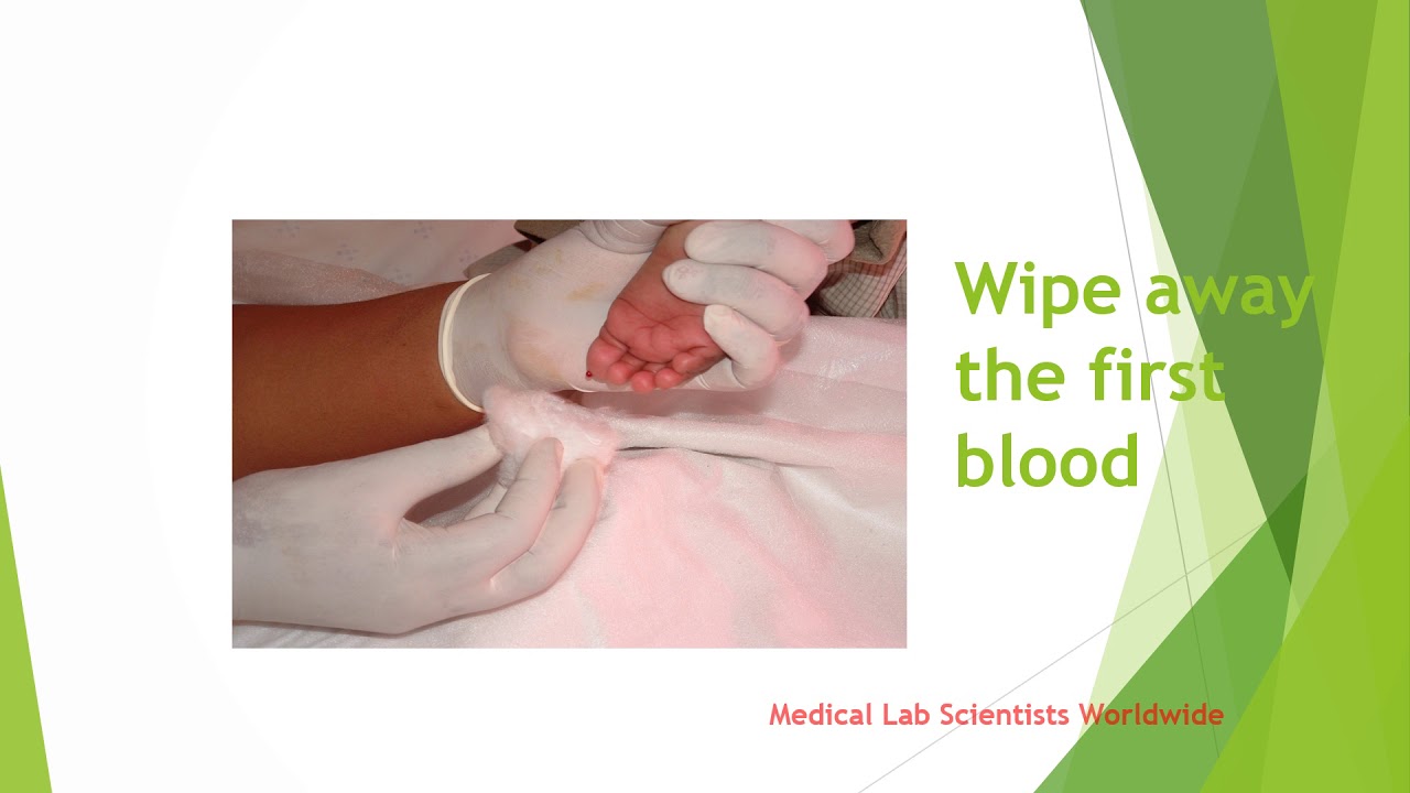 LEARN HOW TO AND MANAGE COLLECT DBS SAMPLES - YouTube