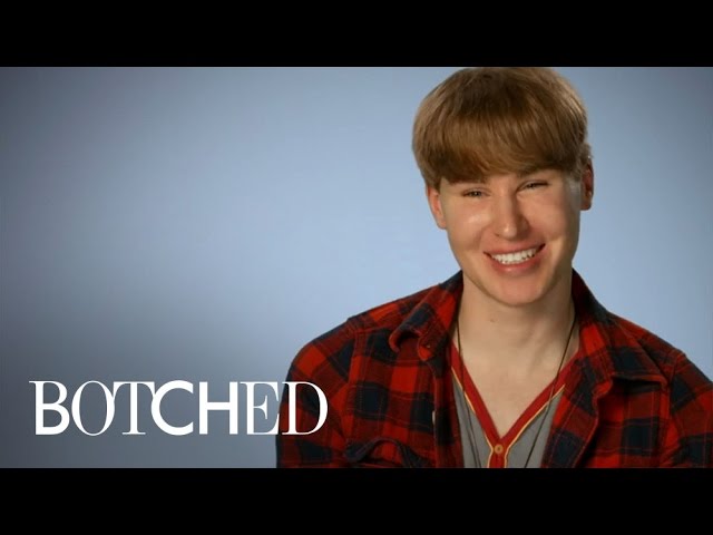 Justin Bieber Look Alike Botched