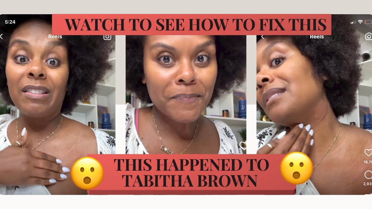 How to Cure Unknown Skin Rash/Hives Naturally - YouTube