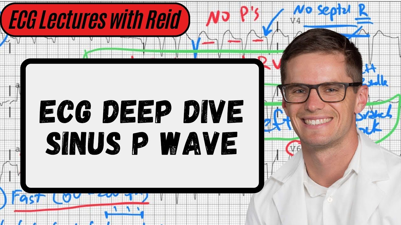 The Sinus P Wave (High Yield ECG) - YouTube