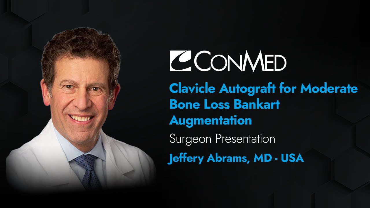 Dr. Jeffrey Abrams - PRESENTATION (2021): Clavicle Autograft Moderate ...