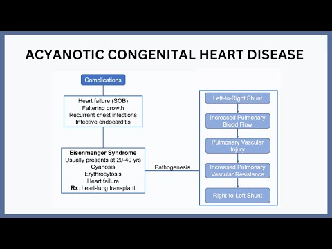 Acyanotic Congenital Heart Disease Explained