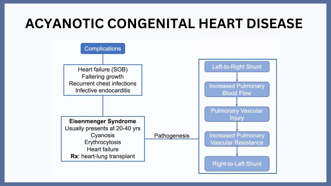 Acyanotic Congenital Heart Disease Explained - YouTube