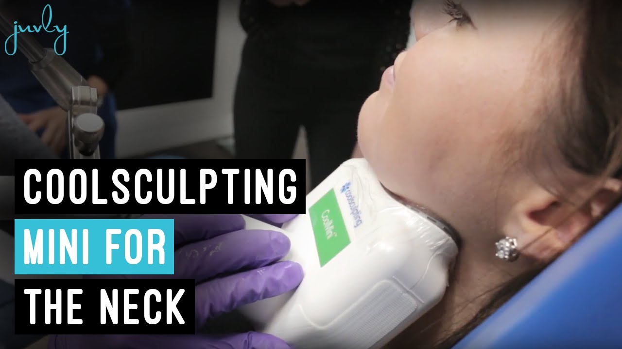 CoolSculpting Mini for the Neck | Body Contouring Procedures | Juvly ...