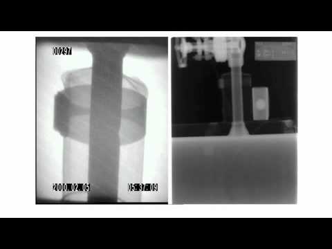 RTR_Real Time Radiography - YouTube