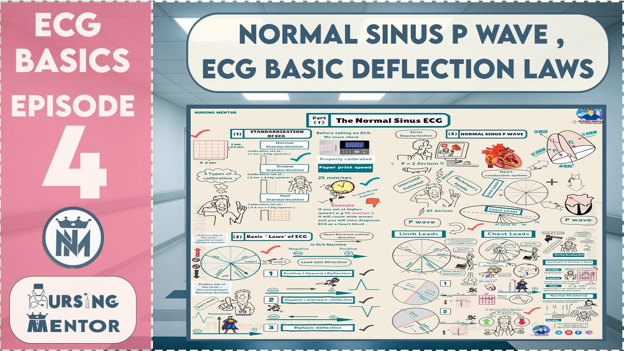 Normal Sinus P wave ,ECG basic Deflection Laws and ECG Standardization ...