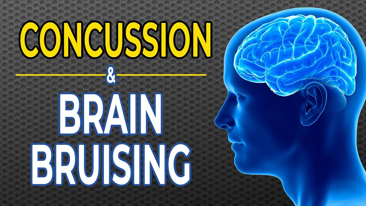 Traumatic Brain Injury | Do Concussions Cause Brain Bruising? - YouTube