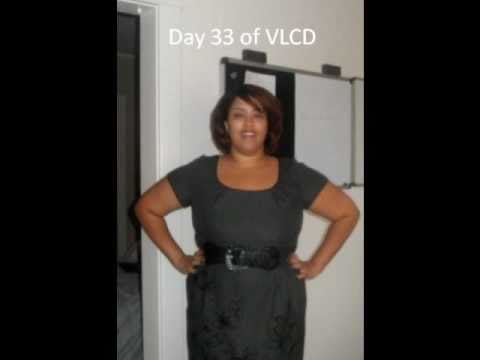 HCG VLCD Day33 Before and After Pics - YouTube