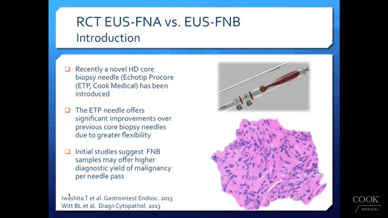 1-4 Investigators & Study Design: Comparing EUS-Guided FNA vs. FNB for ...