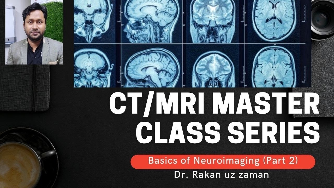 Basics of Neuroimaging part 2 CT/MRI Master class series - YouTube