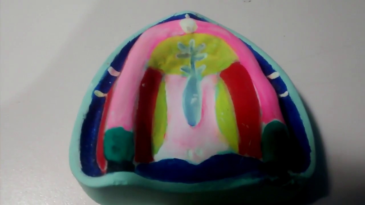 Maxillary Cast Landmarks: Relief Areas - YouTube