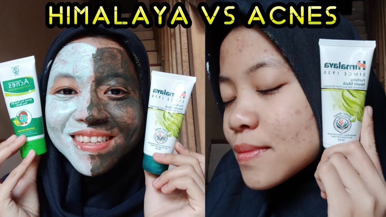 Acnes Tea Tree Oil Clay Mask VS Himalaya Neem Mask - YouTube