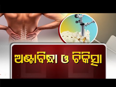 Doctor Doctor | Back Pain - Diagnosis and Treatment - YouTube