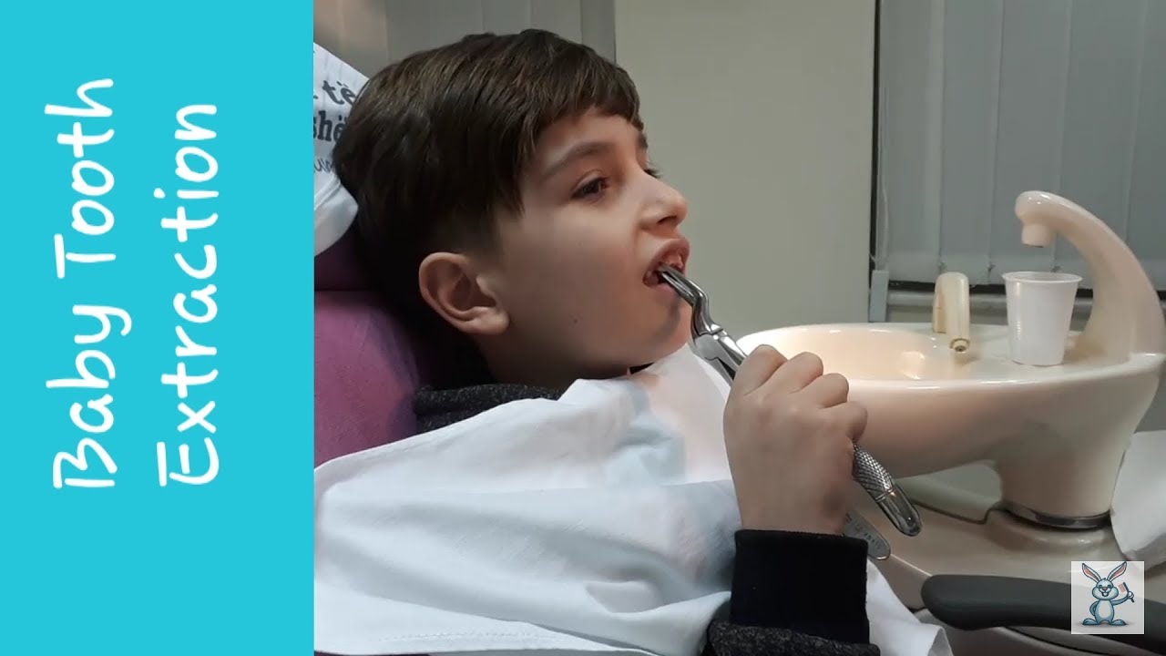 Milk teeth extraction by Narti and his Friends at the dentist office ...