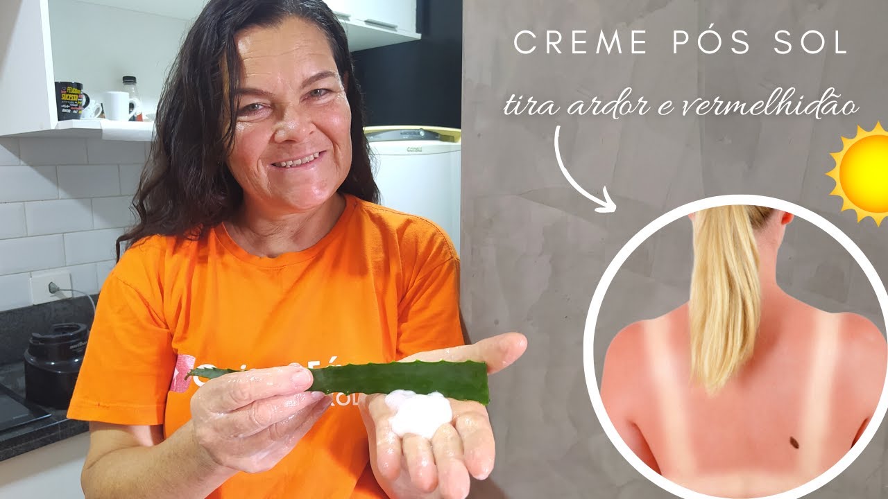 ☀ Loção pós praia, tira ardor e vermelhidão da pele queimada pelo sol ...