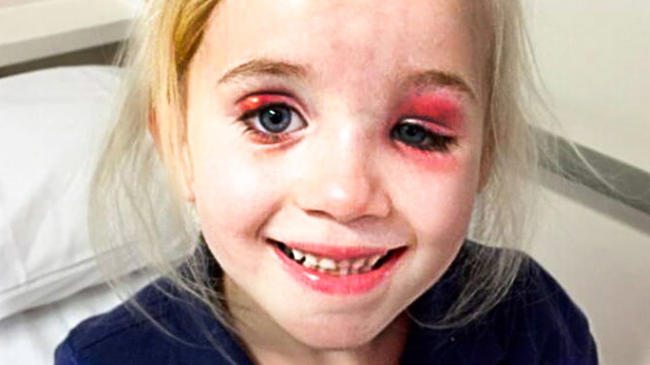 Her Smile Looked Weird... Then Doctors Shocked Us... - YouTube