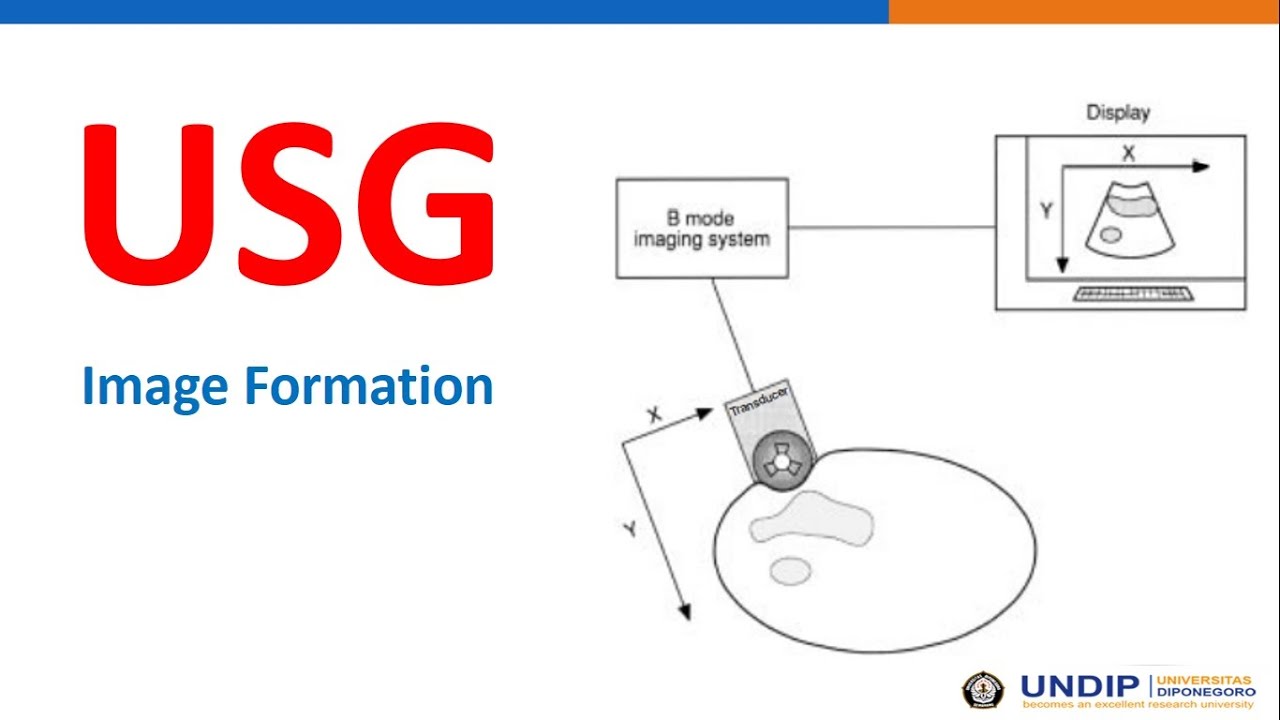 USG 5: Image Formation - YouTube