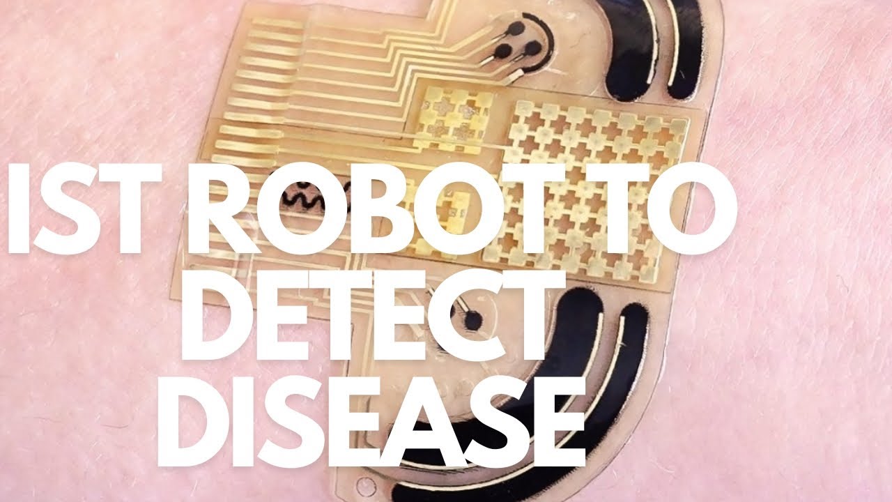 Revolutionary Chinese Innovation: The First Robot to Detect Diseases in ...