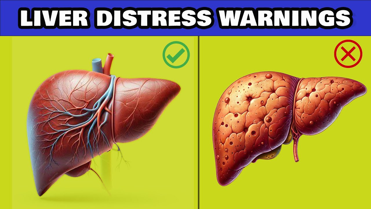 10 Warning Signs Your Liver May Be in Distress | Health And Well-Being ...
