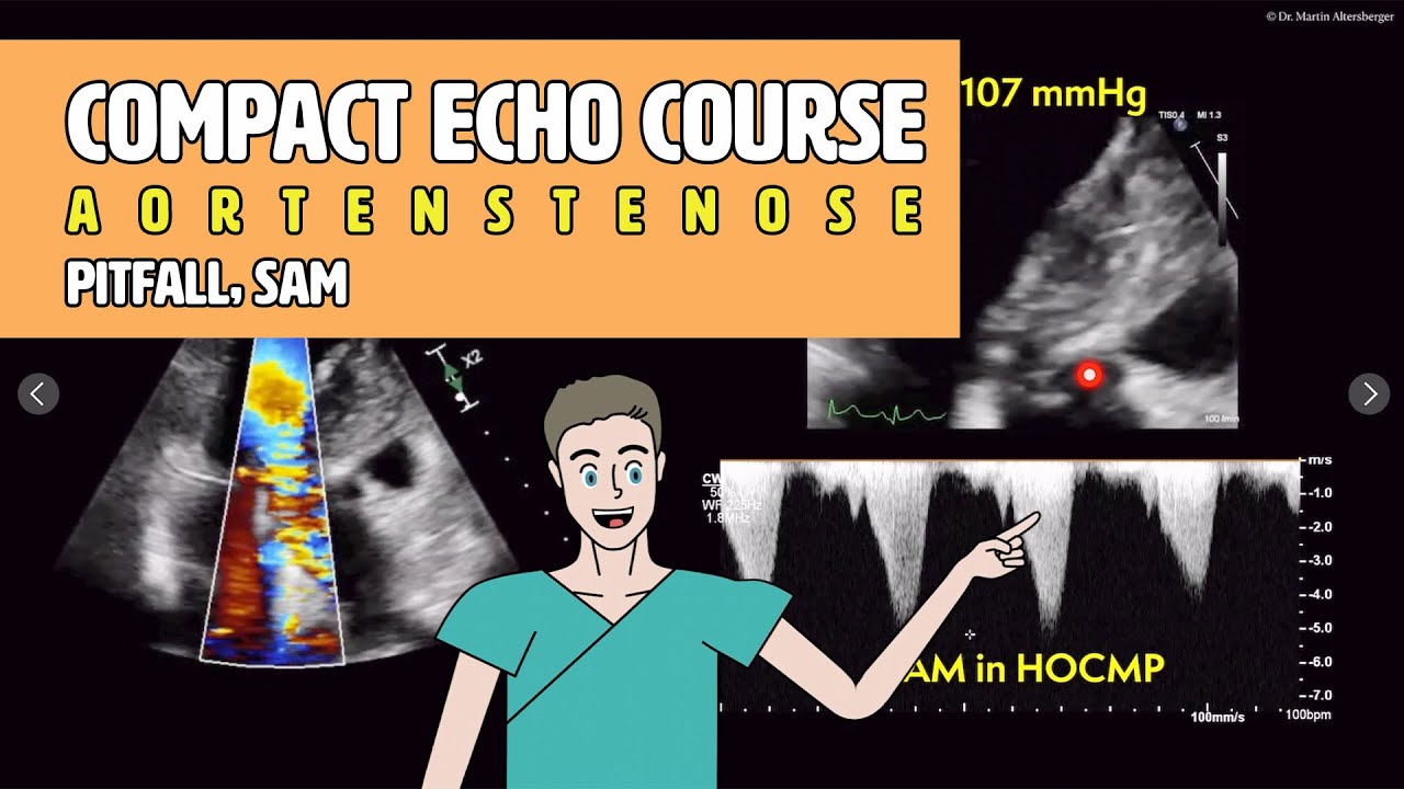 〖Echokardiografie〗 LVOT Obstruktion & SAM - Pitfalls der ...