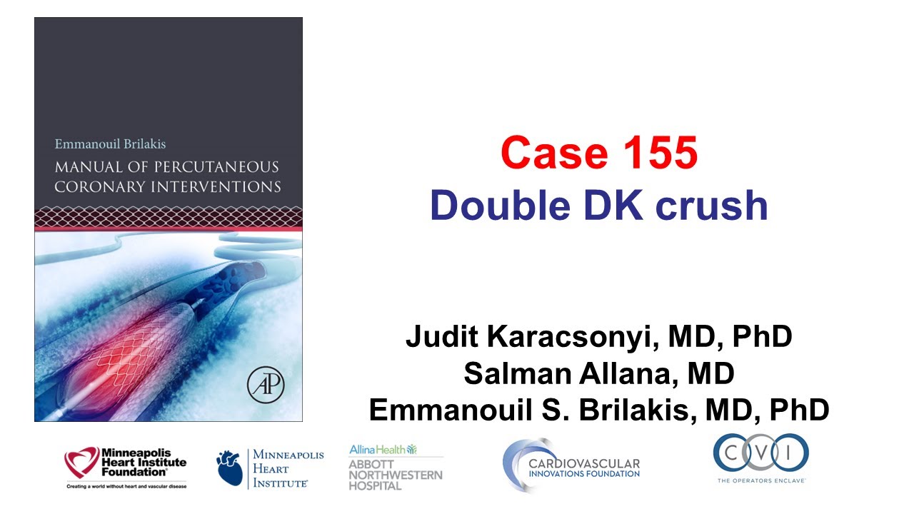 Case 155: Manual of PCI - Double DK crush - YouTube