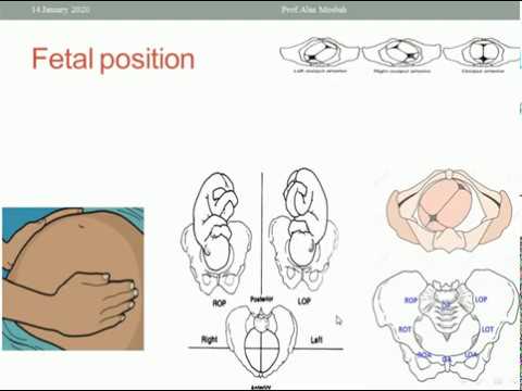 Fetal lie, presentation and position - YouTube